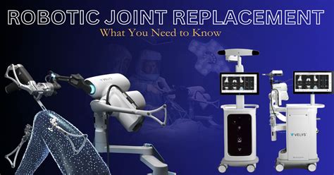 The Benefits And Risks Of Robotic Joint Replacement Dr Rohit Damor