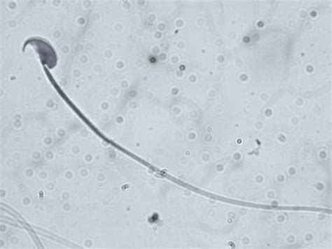 Bfs Homepage Sperm Of A Mouse