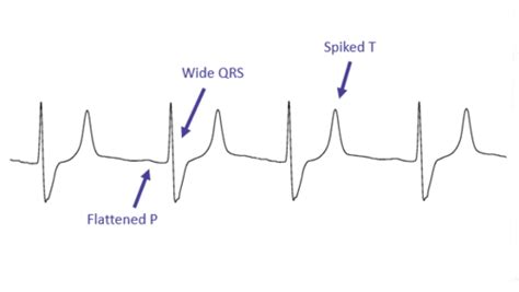Hypoadrenocorticism And Calcium Disorders Cartes Quizlet
