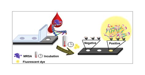 Fluorometric Paper Based Loop Mediated Isothermal Amplification Devices For Quantitative Point