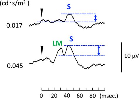 Measuring The Amplitude Of The S Cone Erg In A Response To A Dim