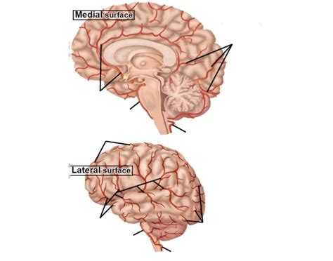 Cerebral Vascular Territories Quiz