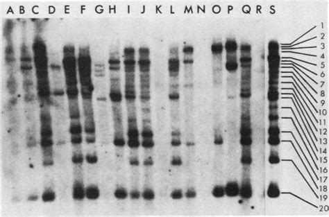 Segregation Of Human B Actin Gene Sequences Between Human Mouse