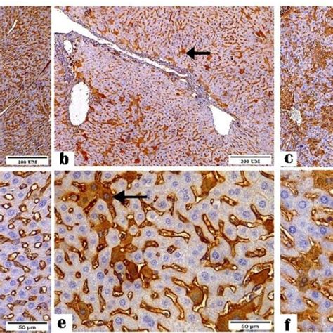 Photomicrographs Showing Cd8⁺ Antibody Reactivity In The Ileal Tissue