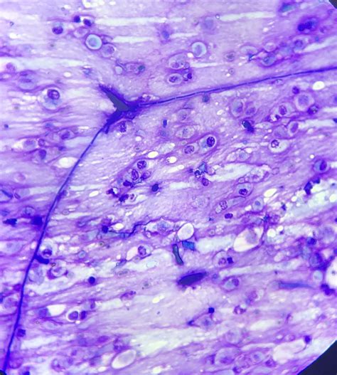 Ox Spinal Cord Smear