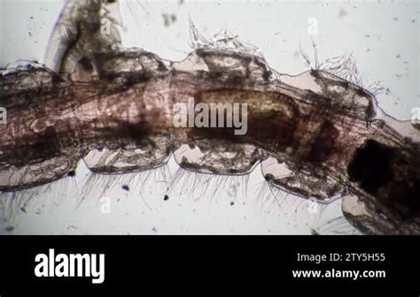 Digestive System Of A Mosquito Larva Chironomidae In A Microscope Stock