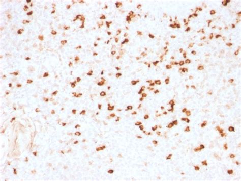 Lambda Light Chain B Cell Marker Monoclonal Antibody N102 3535