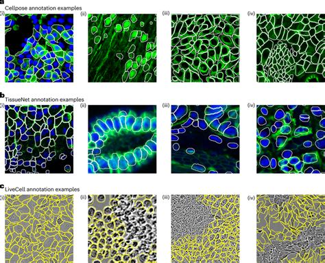 Diverse Annotation Styles Across Ground Truth Datasets These Are