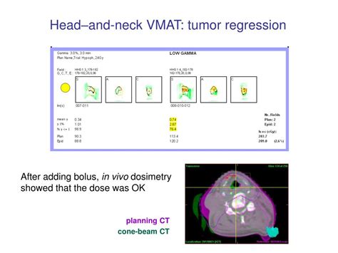 Ppt Clinical Implementation Of 3d Epid Based In Vivo Dose Verification Of Imrtvmat Treatments
