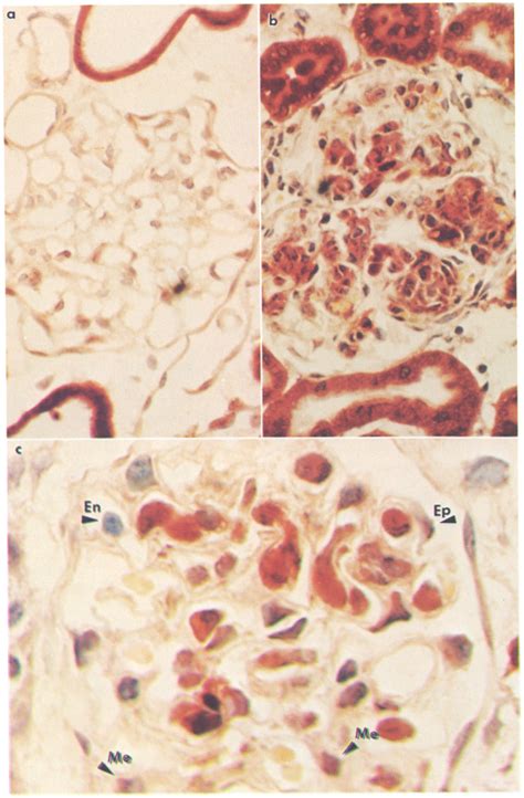 Nonspecific Esterase Nse Stains Of Rabbit Glomeruli A Glomerulus