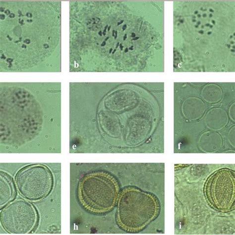 Phases Of Meiosis Microsporogenesis In Male Fertile Flowers A Download Scientific Diagram
