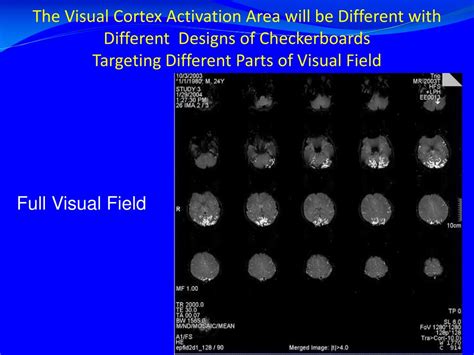 Ppt Daily Fmri Practice Powerpoint Presentation Free Download Id 3625546