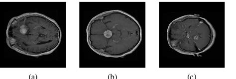 Figure From A Triple Level Ensemble Based Brain Tumor Classification Using Dense ResNet In