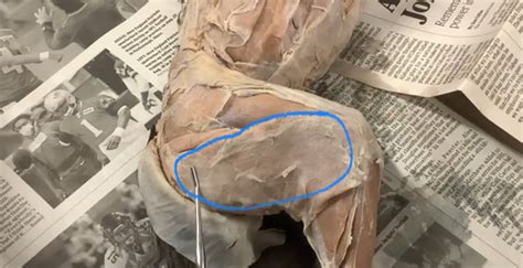 Practical 2 Flashcards Quizlet