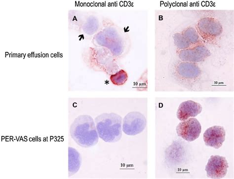 Immunocytochemistry On Primary Effusion Cells A B And Per Vas Cell
