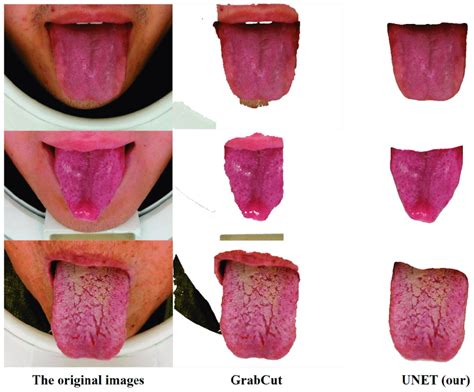 Segmentation Effect Comparison Download Scientific Diagram