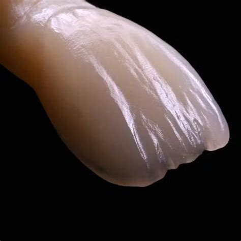 Figure 3 Composite Resin Specimen With Histo Anatomic Layering Only Two Masses Were Used With