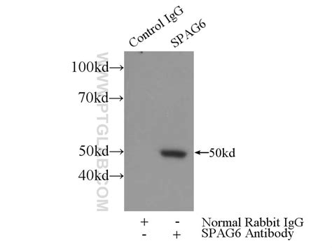 Spag6 Antibody 12462 1 Ap Proteintech