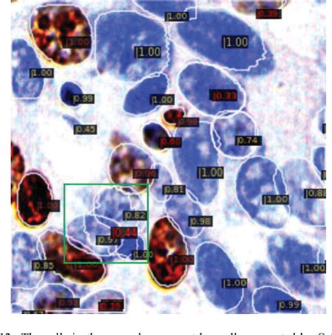 figure 12 from oriented cascade mask r cnn for biomedical image