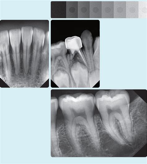 Ezsensor Classic Vatech