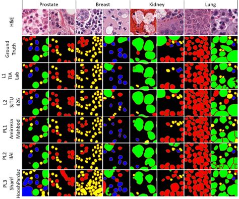 Figure 2 From Monusac2020 A Multi Organ Nuclei Segmentation And Classification Challenge