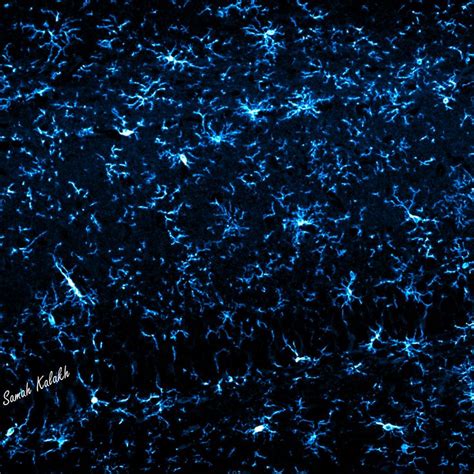 Microglia In The Hippocampus