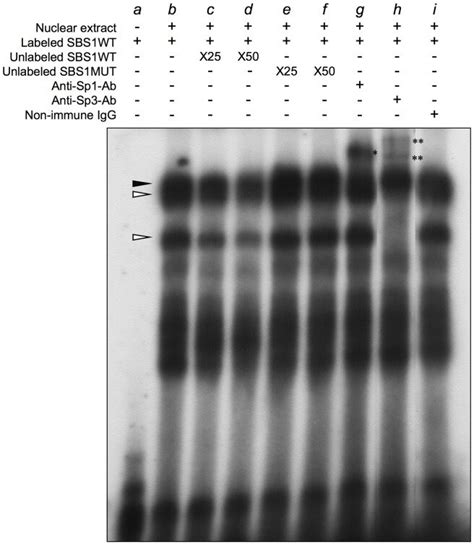 Emsa Was Performed To Analyze The Binding Ability Of Putative