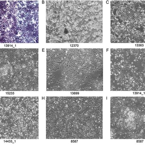 Scratch Assays Showing Cell Mobility Pictures Were Taken At 0 H And 48
