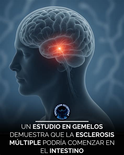 Prof La Esclerosis Múltiple Em Una Enfermedad Neurológica
