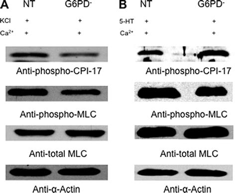 Hypoxia Induced Ca 2 Independent And Dependent Phosphorylation Of