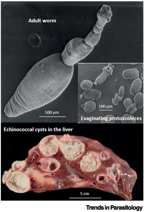 Echinococcus Granulosus Sensu Lato Trends In Parasitology