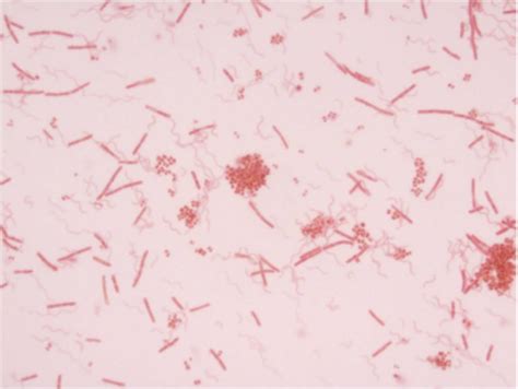 Microbiology Lab Practical Flashcards Quizlet