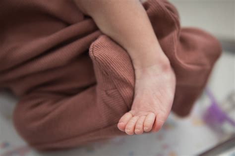 Israel Sees Its First Ever Case Of Rare Rapid Aging Benjamin Button