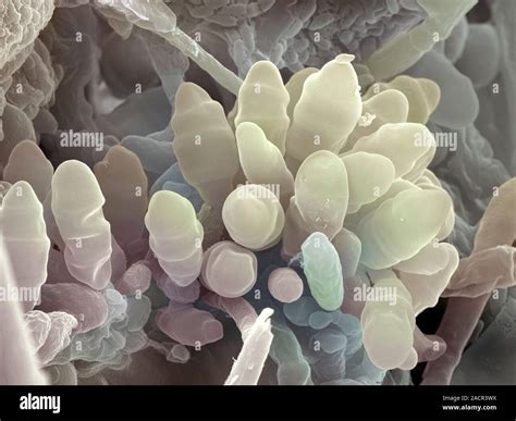 Apple Tree Fungus Coloured Scanning Electron Micrograph Sem Of Fungal Spores Bursting Through