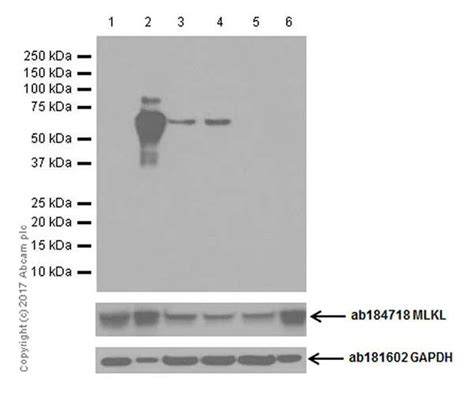 Mlkl 磷酸化y222 抗体[epr19816] Ab206336 Abcam中文官网