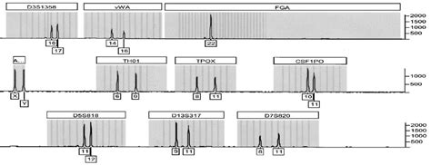 Figure 1 From Sperm Dna Extraction From Mixed Stains Using The Differex