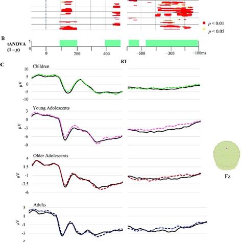 Condition Averaged Stimulus And Response Locked Event Related