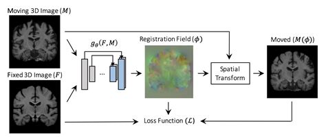 [review] An Unsupervised Learning Model For Deformable Medical Image