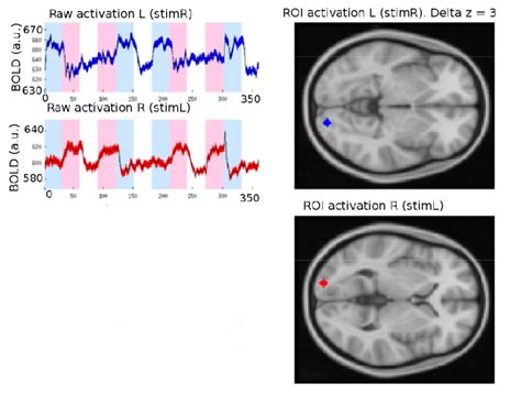 9 Roi Selection And Average Responses During Functional Localizer In A