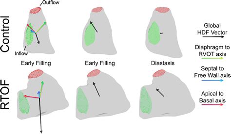 Frontiers Abnormal Diastolic Hemodynamic Forces A Link Between Right Ventricular Wall Motion