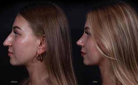 Good Nose Jobs
