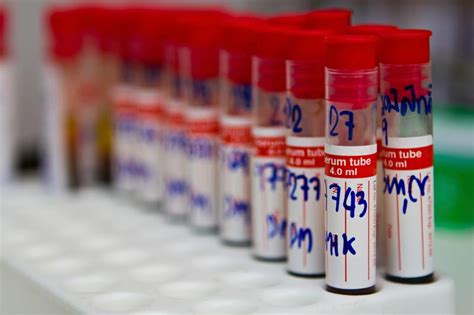 Are Genital Warts Benign Or Malignant Std Testing In North Haven Ct Reveals The Answer