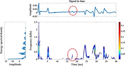 Reassigned Spectrogram Of The Analysed Signal Download Scientific Diagram