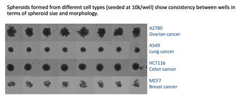 Spheroid Assays Cellomatics Biosciences