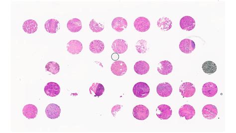 Rna Seq Services Tristar