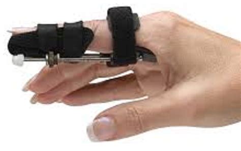 Static Progressive Pip Finger Extension Splint Ebay