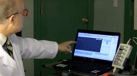 Ncv Exam Ulnar Motor Cloudemg