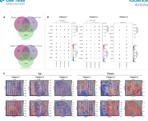 Figure 1 From Visium Spatial Transcriptomics Reveals Intratumor Heterogeneity And Profiles Of