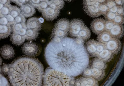 Fungal Cell Microscope