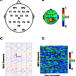 EEG Signal Analysis